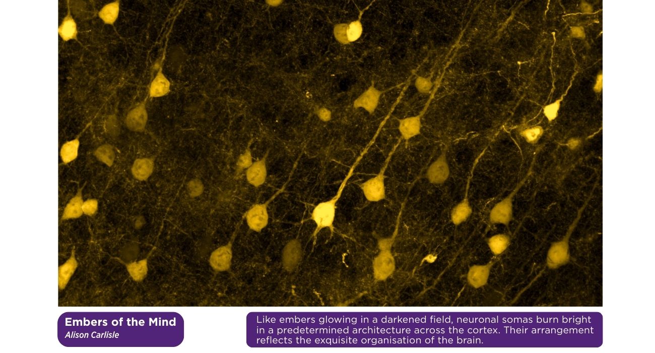 QBI 2025 Awards and Achievements - Queensland Brain Institute ...