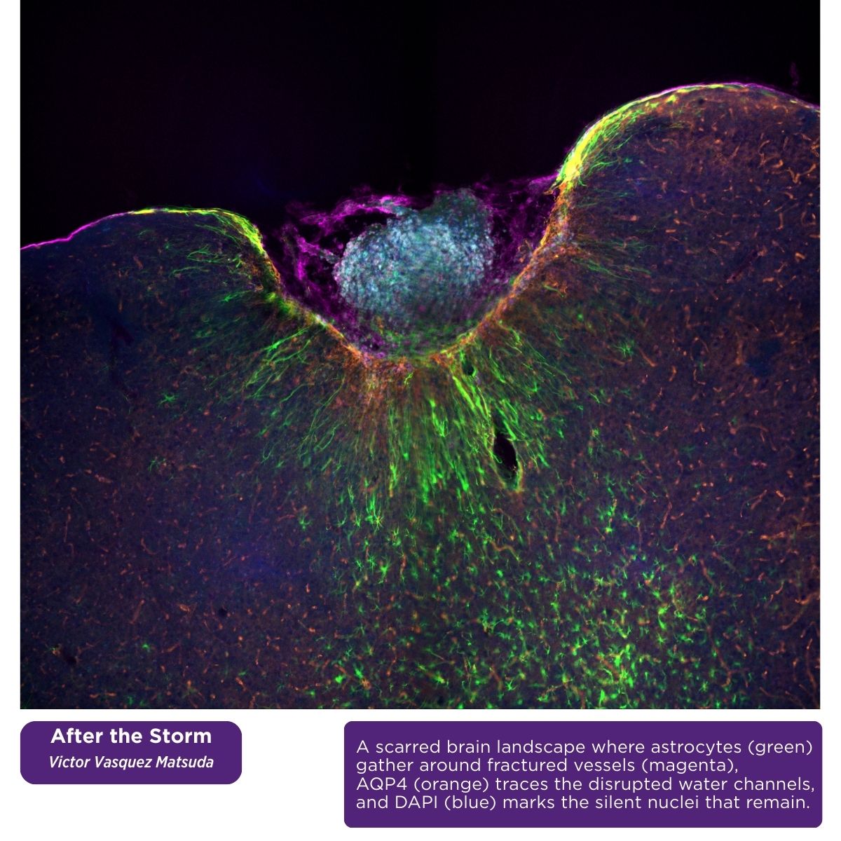 QBI 2025 Awards and Achievements - Queensland Brain Institute ...