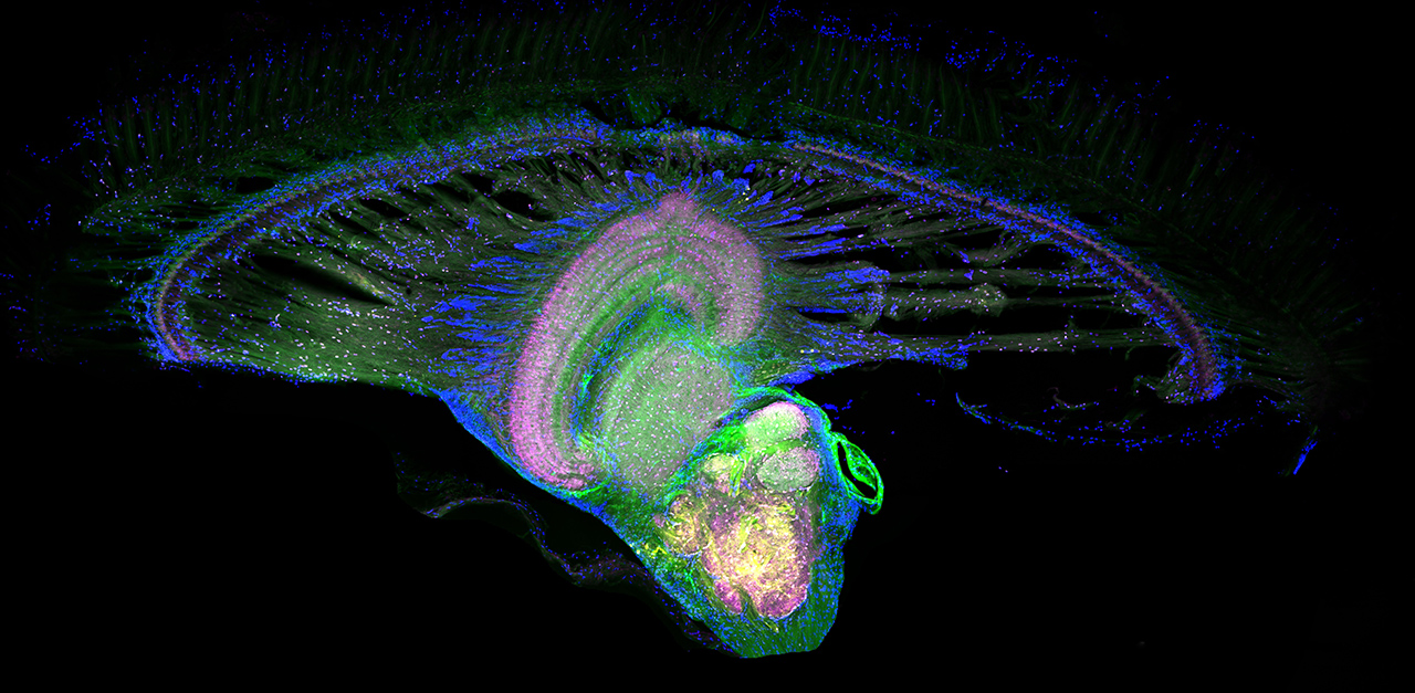 Best neuroscience images of 2015 - Queensland Brain Institute ...