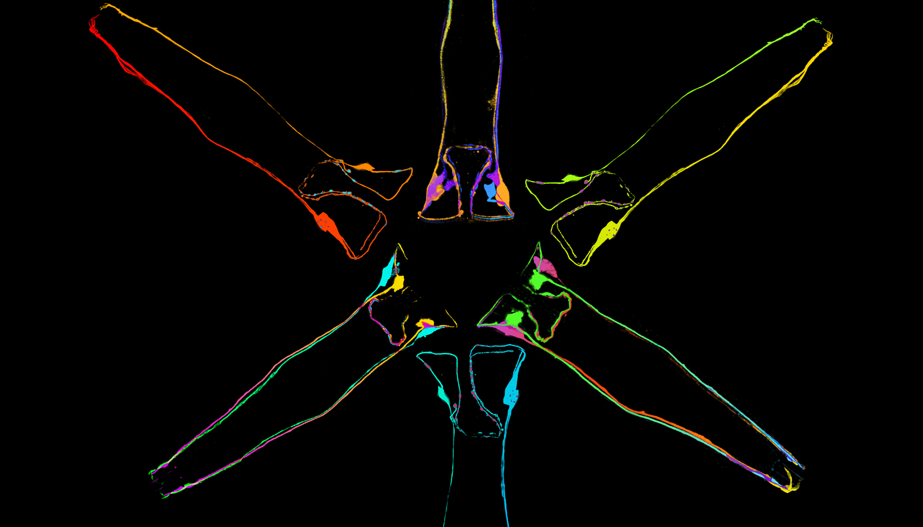Faulty brain circuits arise from abnormal fusion - Queensland Brain ...
